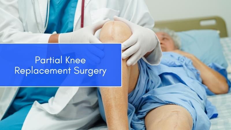 Understanding of Partial Knee Replacement Surgery